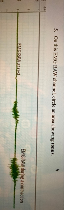 Solved 5. On this EMG RAW channel, circle an area showing | Chegg.com