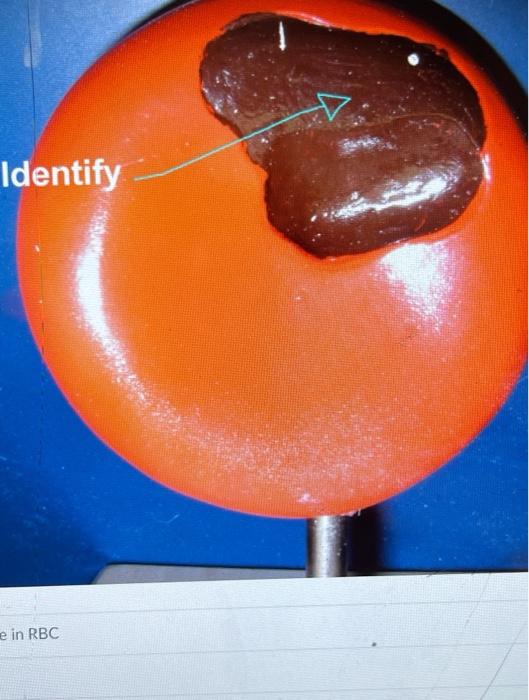 Solved Identify e in RBC O metabolic waste in RBC O iron | Chegg.com