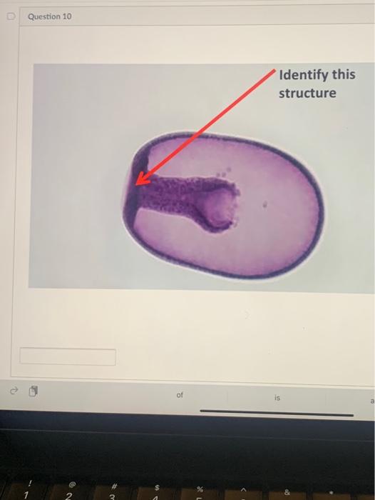 Solved Question 10 Identify this structure of is a | Chegg.com