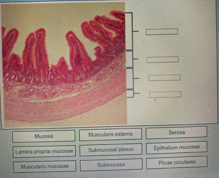 Solved Villus Simple columnar epithelium Lamina propria | Chegg.com