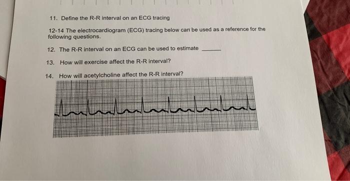 Solved 11. Define the R-R interval on an ECG tracing 12-14 | Chegg.com
