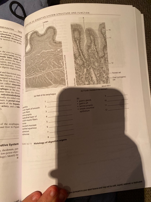 Solved ISTEM STRUCTURE AND FUNCTION 34 DIGESTIVE SYST AND | Chegg.com