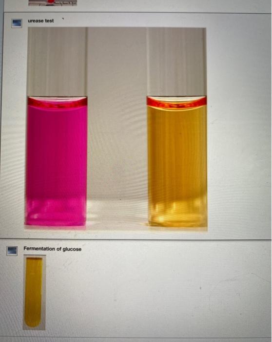 Solved urease test Fermentation of glucose fermentation of | Chegg.com