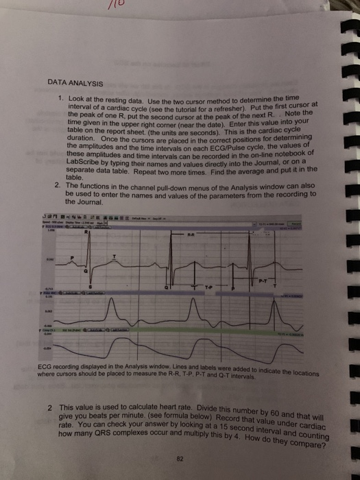 Effect of Exercise on the ECG Exercise produces | Chegg.com