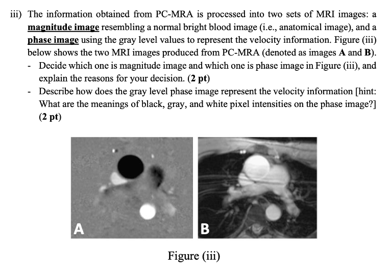 Solved iii) ﻿The information obtained from PC-MRA is | Chegg.com