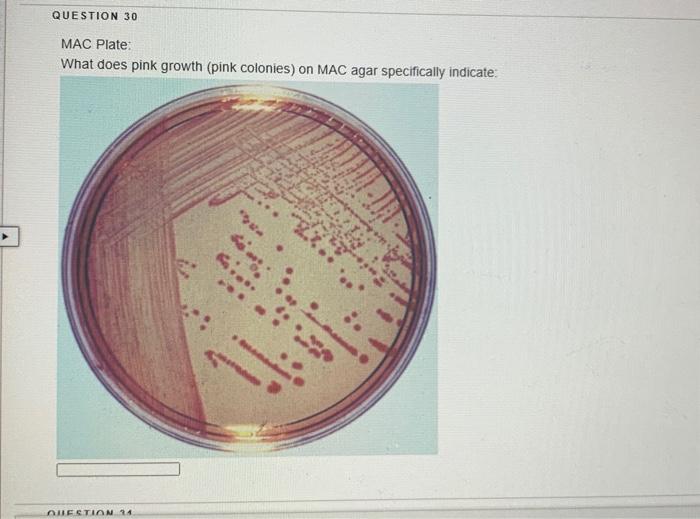 Solved QUESTION 30 MAC Plate: What does pink growth (pink | Chegg.com