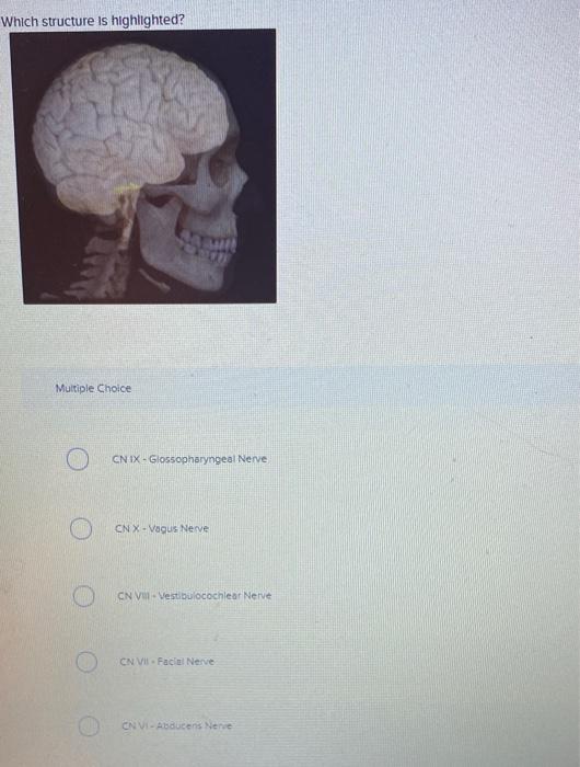 Solved Which structure is highlighted? Multiple Choice CN | Chegg.com