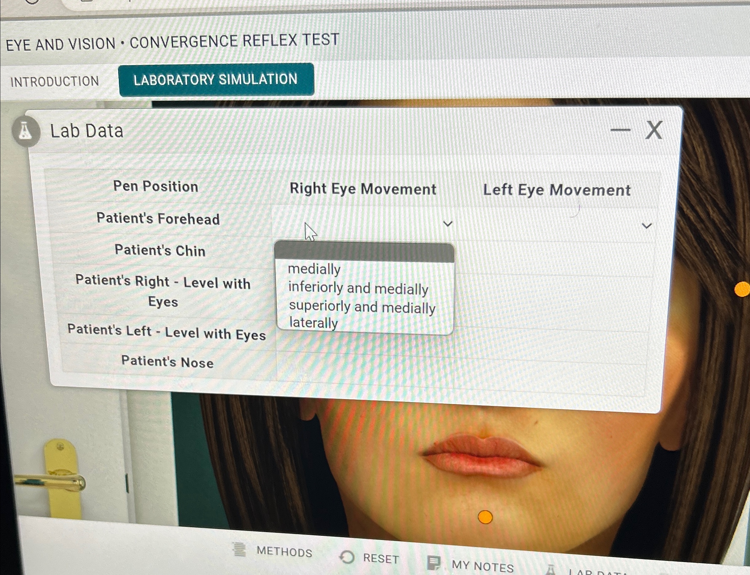 Solved EYE AND VISION * ﻿CONVERGENCE REFLEX | Chegg.com