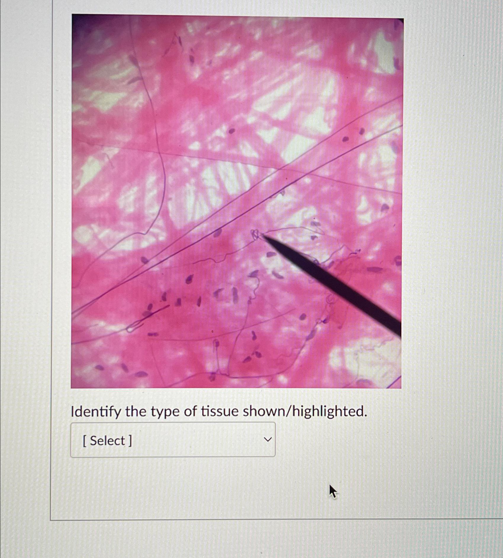Solved Identify the type of tissue shown/highlighted. | Chegg.com