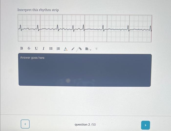 Interpret this rhythm strip Interpret this rhythm | Chegg.com