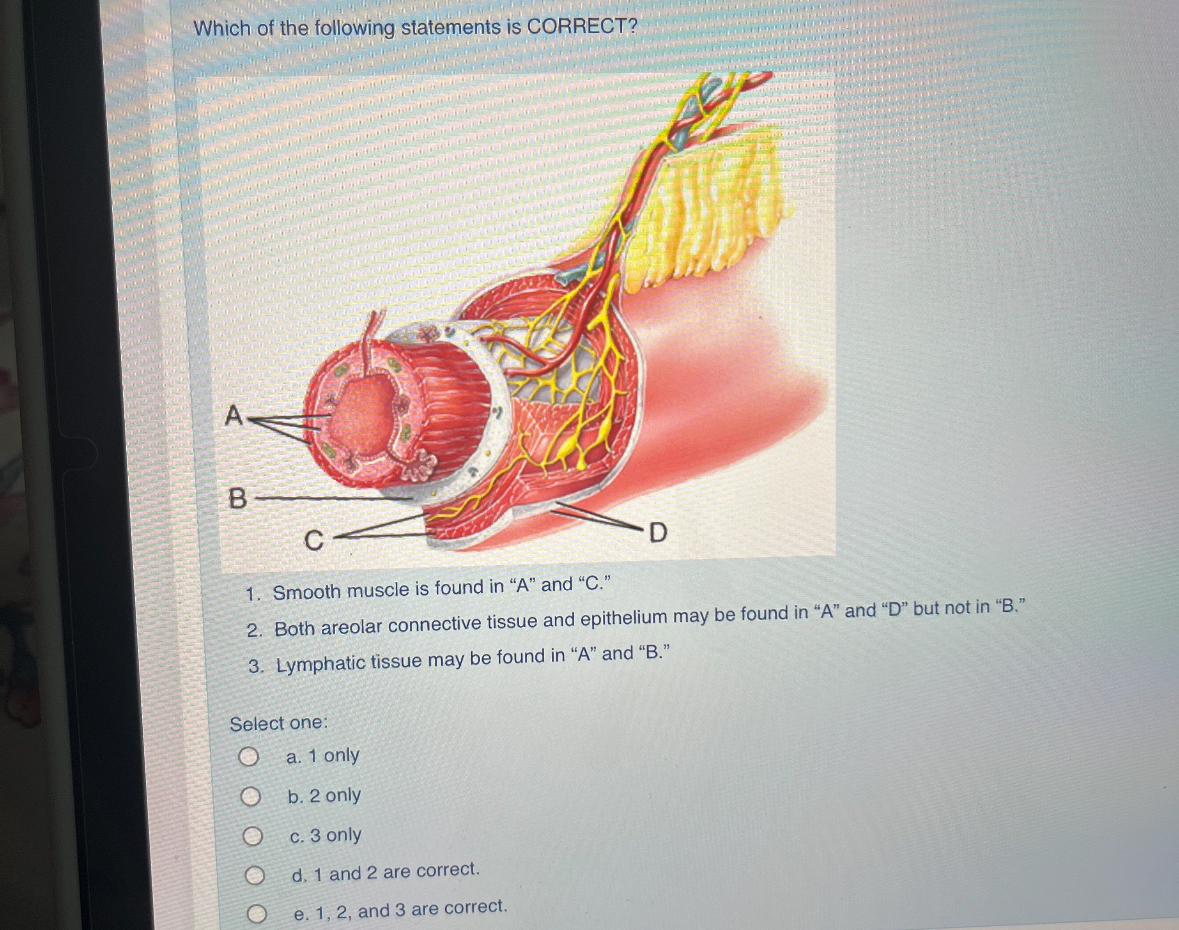 Solved Which of the following statements is CORRECT?Smooth | Chegg.com