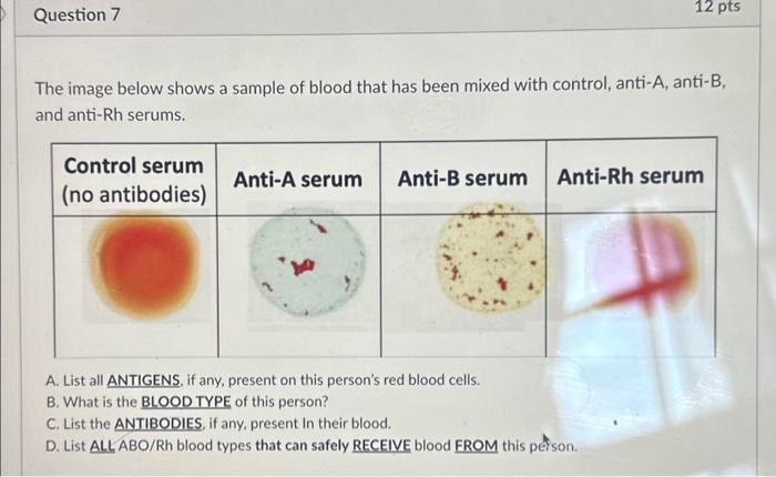 Solved Question 7 The image below shows a sample of blood | Chegg.com