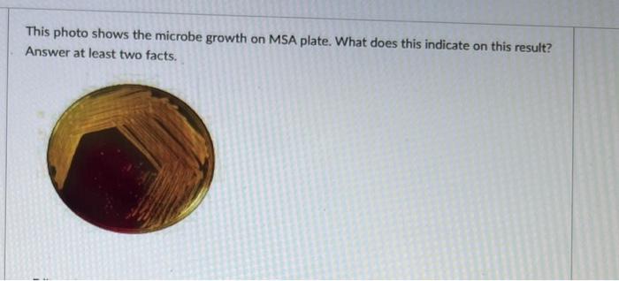 Solved This photo shows the microbe growth on MSA plate. | Chegg.com
