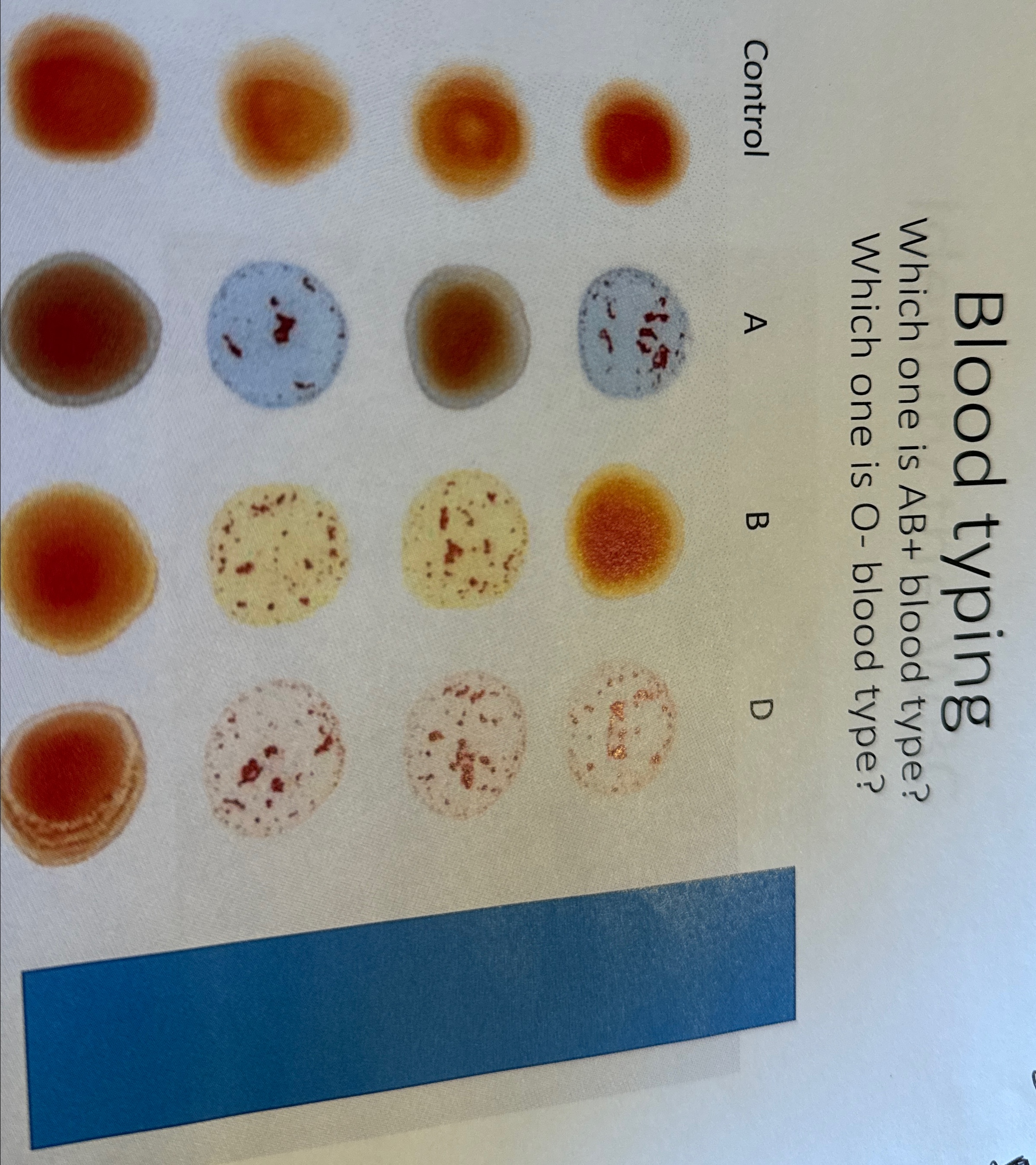 Solved Blood typingWhich one is AB+ ﻿blood type?Which one is | Chegg.com
