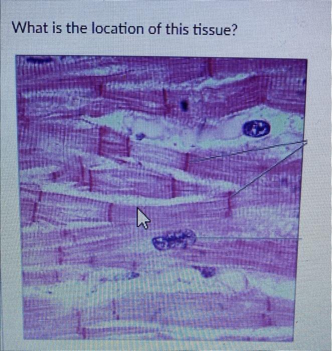 Solved What is the location of this tissue? D 1 OC o What | Chegg.com