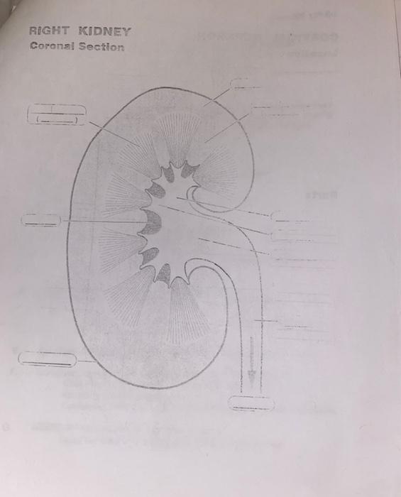 Solved RIGHT KIDNEY Coronal Section | Chegg.com