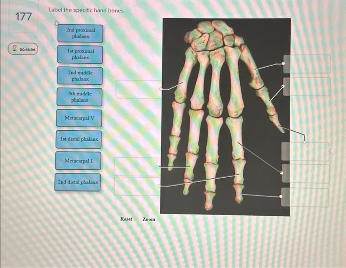 Solved Label the specific hand bones | Chegg.com