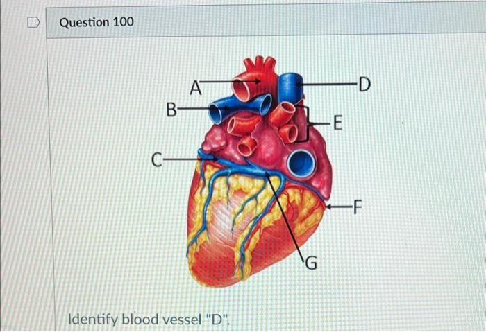 Solved Identify blood vessel "D". Identify structure | Chegg.com