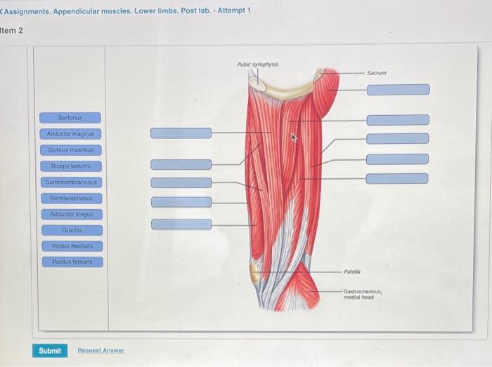 Solved Assignments. Appendicular muscles. Lower limbs. Post | Chegg.com