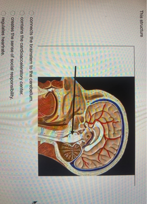 Solved This structure 7 connects the brainstem to the | Chegg.com