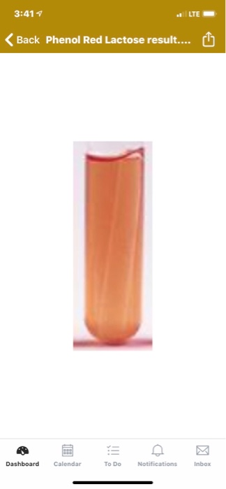 Solved 3:41 vị GE Back Phenol Red Lactose result.... D | Chegg.com