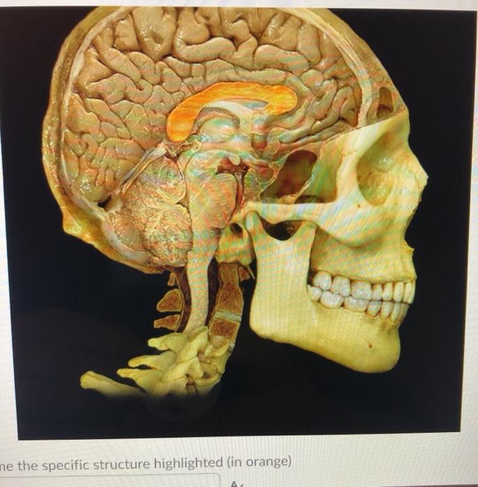 Solved ame the specific structure highlighted (in orange or | Chegg.com