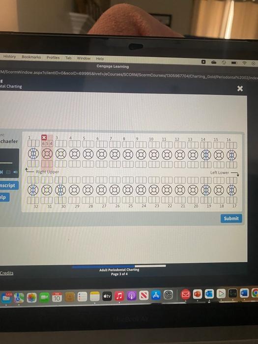 Transcript Stephan Schaefer: Moderate periodontitis | Chegg.com