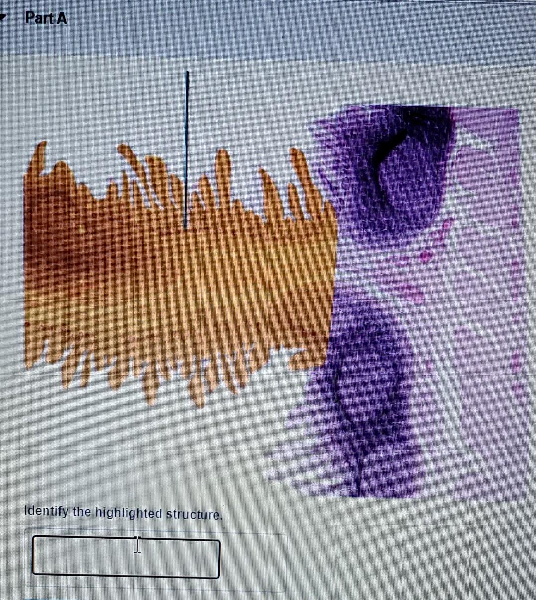 Solved Part A Na Identify the highlighted structure. | Chegg.com