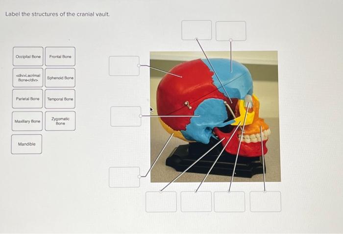 Solved Label the structures of the cranial vault. Occipital | Chegg.com