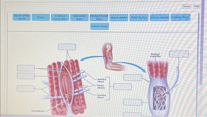 Solved Muscle spindle capsule Tendon Contractile pole | Chegg.com