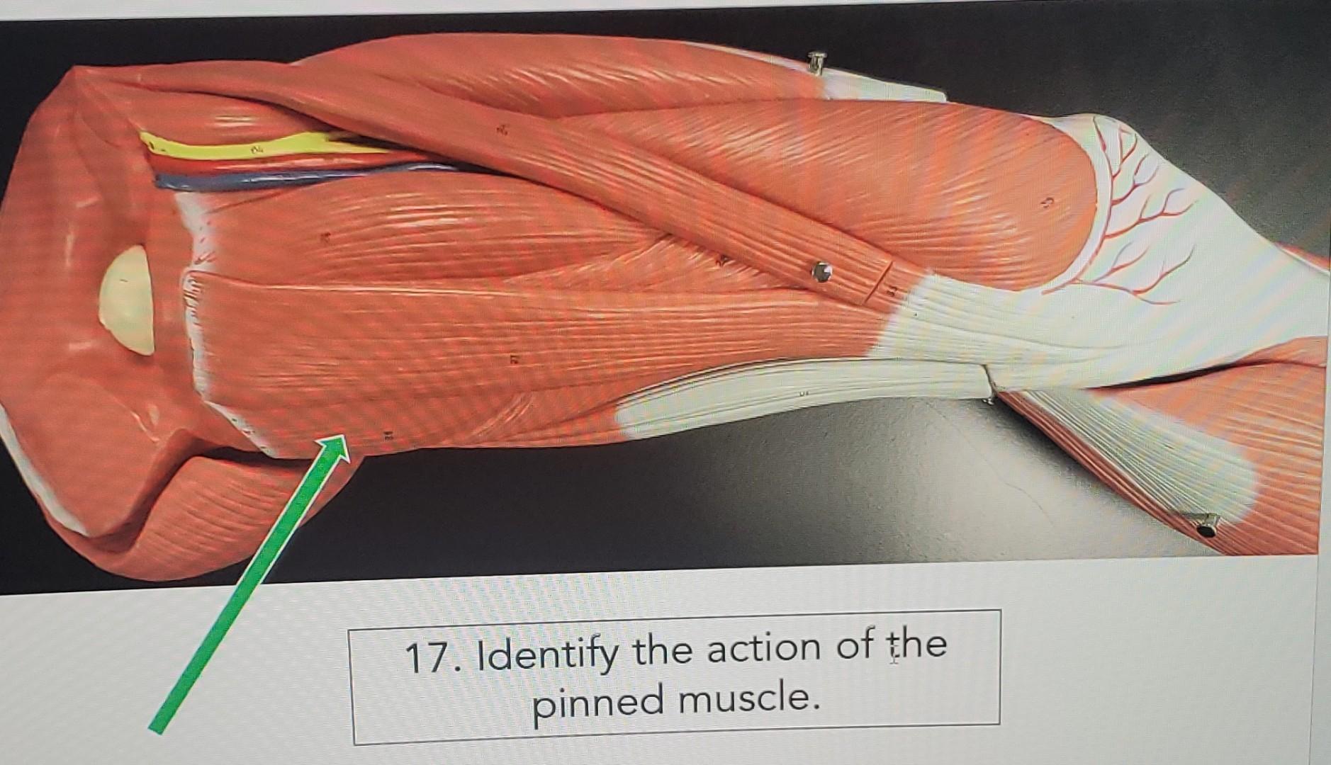 Solved 17. Identify the action of the pinned muscle. | Chegg.com