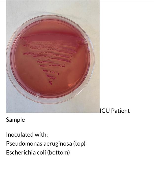 EXERCISE 14: BLOOD AGAR PLATE(BAP) Complete the table | Chegg.com