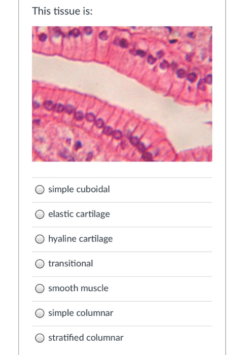Solved Name the tissue, and state a location in the body | Chegg.com