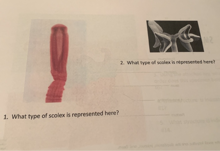 Solved 2 2. What type of scolex is represented here? 1. What | Chegg.com