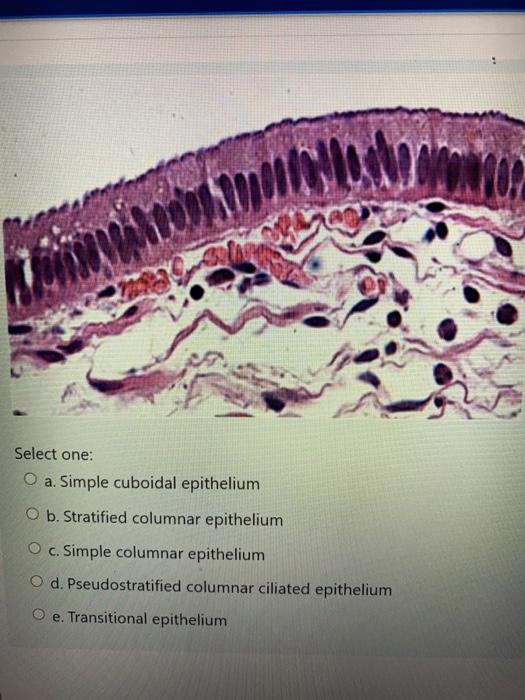 Solved Select one: a. Simple cuboidal epithelium O b. | Chegg.com