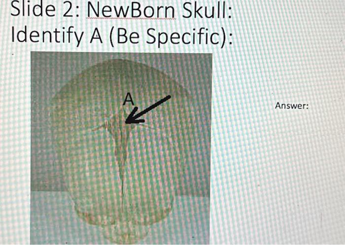 Solved Slide 2: NewBorn Skull: Identify A (Be Specific): | Chegg.com