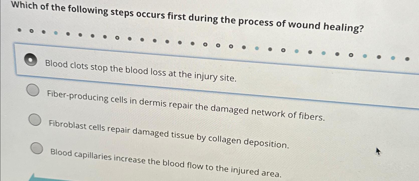 Solved Which of the following steps occurs first during the | Chegg.com
