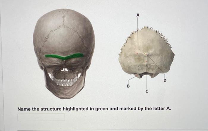 Solved Name the structure highlighted in green and marked by | Chegg.com