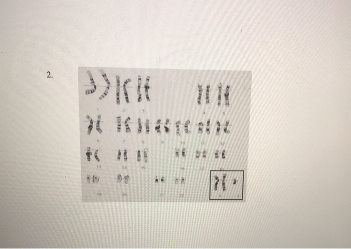 Solved Karyotype Analysis Section : Name: For each karyotype | Chegg.com