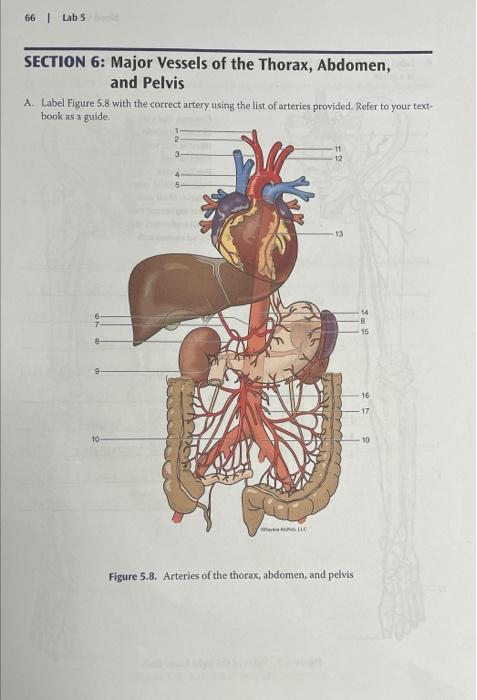 Solved SECTION 6: Major Vessels of the Thorax, Abdomen, and | Chegg.com