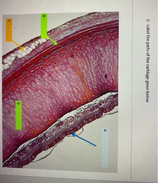 Solved 2. Identify each cartilage below 3. Label the parts | Chegg.com