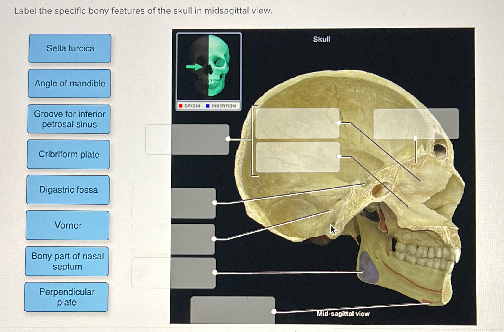 Solved Label the specific bony features of the skull in | Chegg.com Solved Label the specific bony features of the skull in | Chegg.com