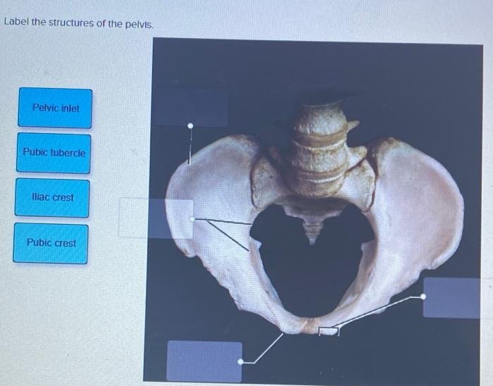 Solved Label the structures of the pelvis. Pelvic inlet | Chegg.com