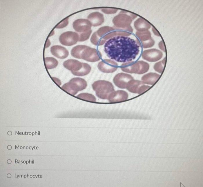 Solved IDENTIFY THE POINTED CELL. O Chief cell O Chromophobe | Chegg.com