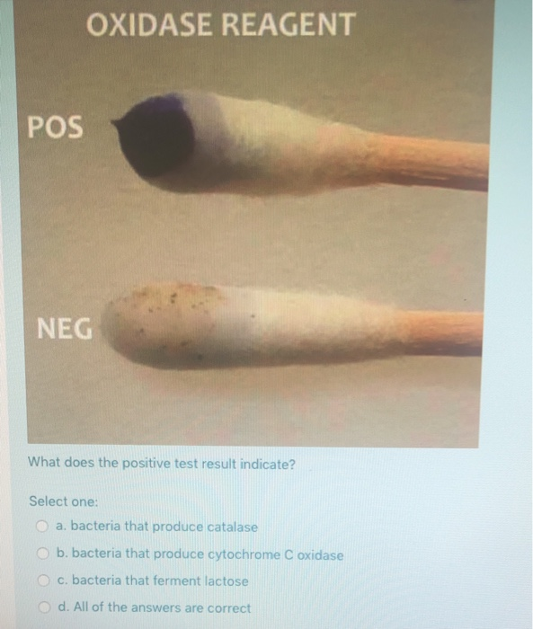 Solved OXIDASE REAGENT POS NEG What does the positive test | Chegg.com