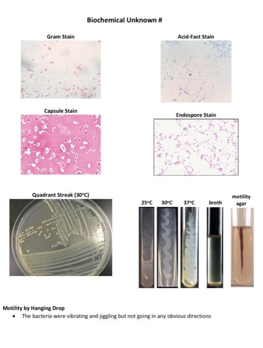 Biochemical Unknown # Gram Stain Acid-Fast Stain | Chegg.com