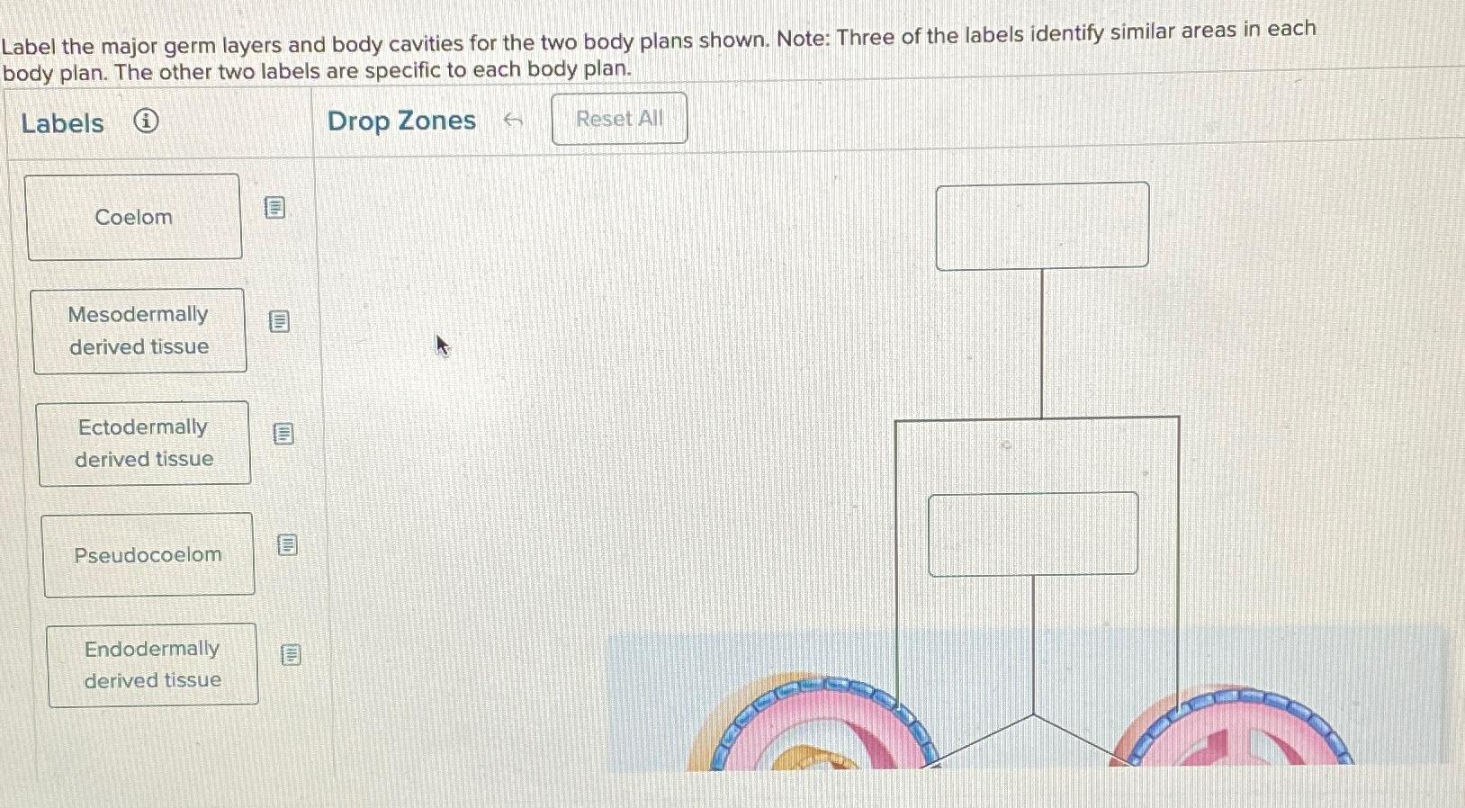 Solved Label the major germ layers and body cavities for the | Chegg.com