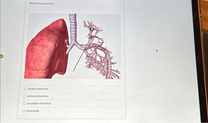 Solved Name the structure: primary bronchus secondary | Chegg.com