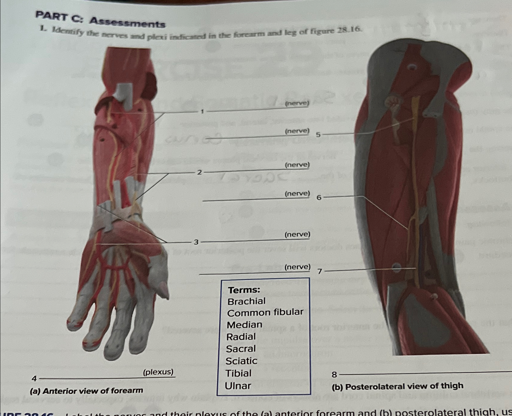 Solved PART C: AssessmentsIdentify the nerves and plexi | Chegg.com
