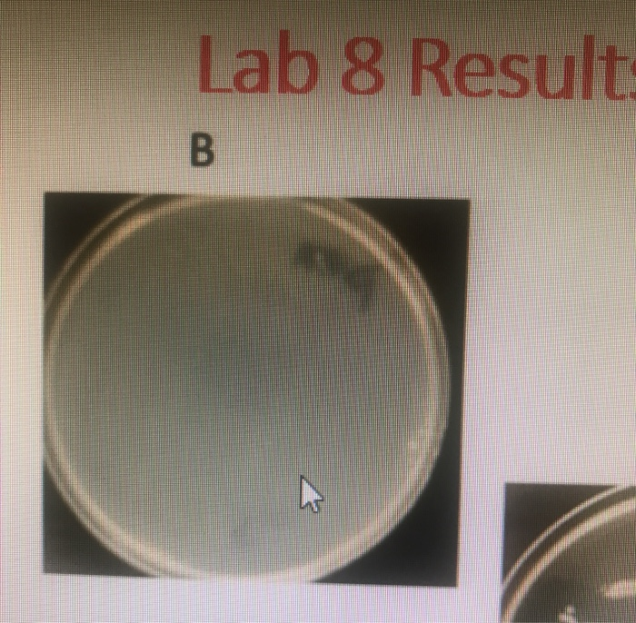 PEA lab 8: Selective, Differential and Enriched | Chegg.com